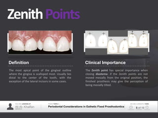 Periodontal Esthetic Considerations in Fixed Prosthodontics | PPTX