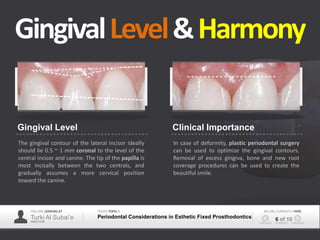 Periodontal Esthetic Considerations in Fixed Prosthodontics | PPTX