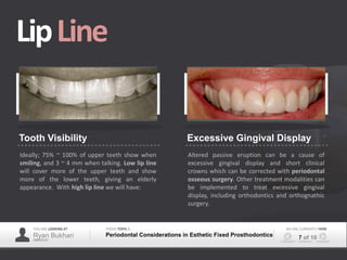 Periodontal Esthetic Considerations in Fixed Prosthodontics | PPTX