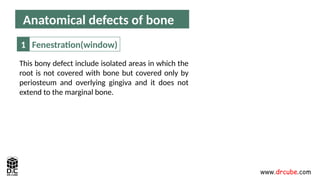 Perio Lec 4 alveolar process .pptxpppppp | PPTX