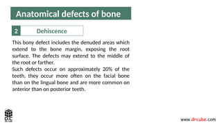 Perio Lec 4 alveolar process .pptxpppppp | PPTX