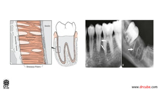 Perio Lec 4 alveolar process .pptxpppppp | PPTX