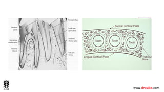 Perio Lec 4 alveolar process .pptxpppppp | PPTX