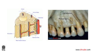 Perio Lec 4 alveolar process .pptxpppppp | PPTX