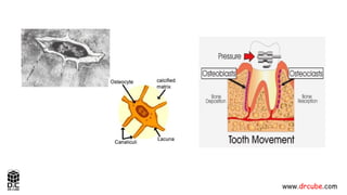 Perio Lec 4 alveolar process .pptxpppppp | PPTX