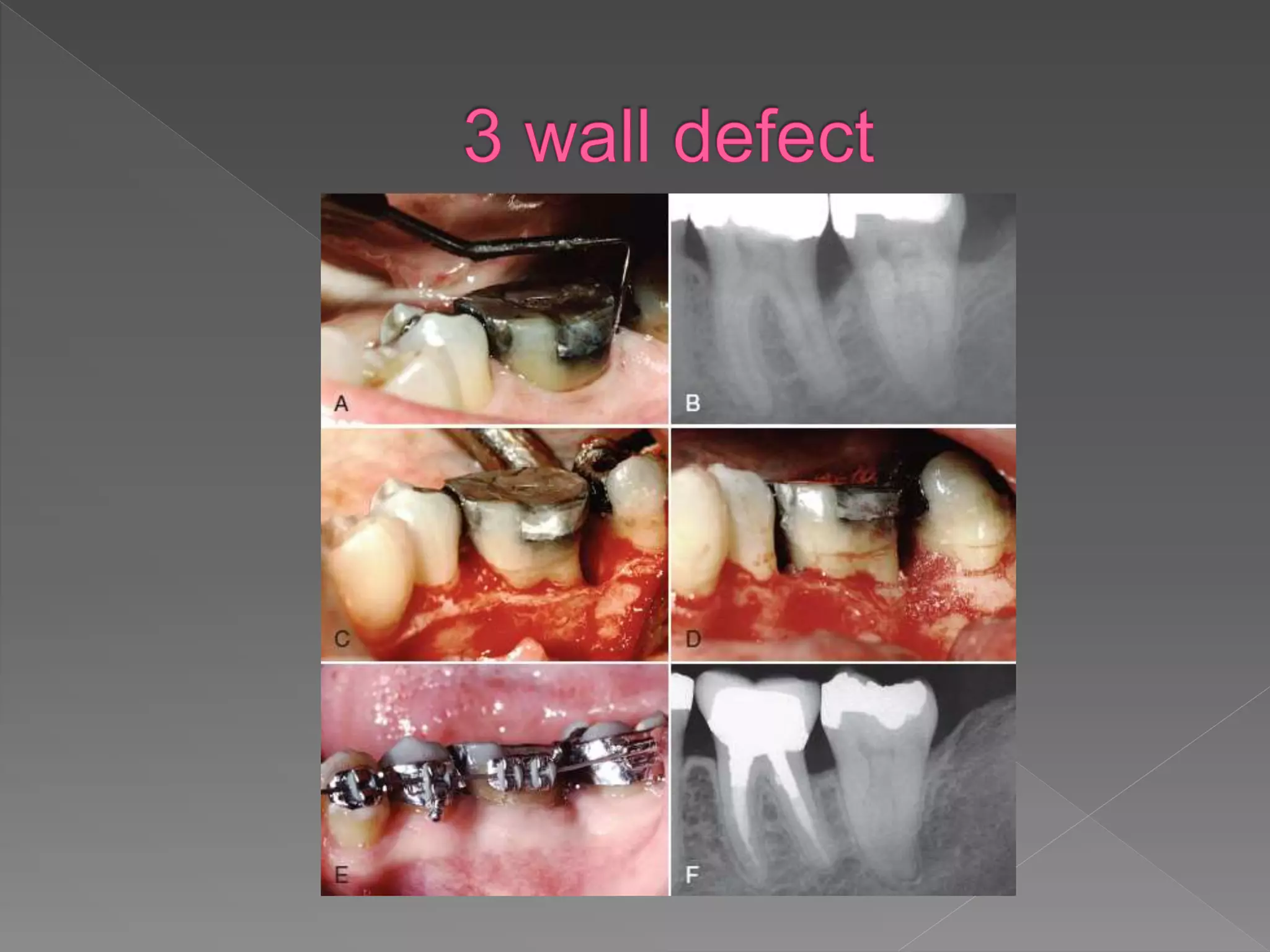 PERIO – ORTHO RELATIONSHIP.pptx