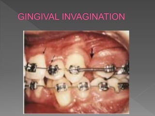 PERIO – ORTHO RELATIONSHIP.pptx