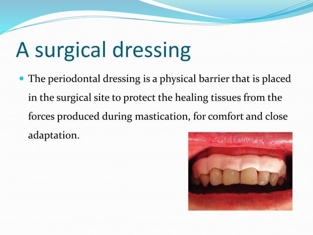Periodontal pack | PPTX | Oral care | Personal Care