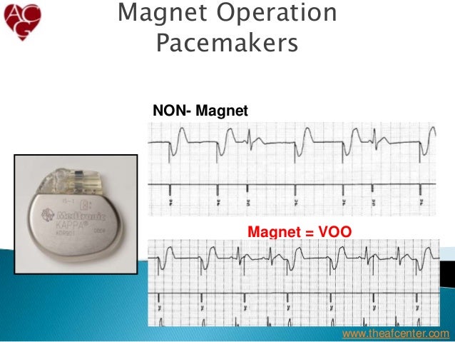 Perioperative cardiac device management