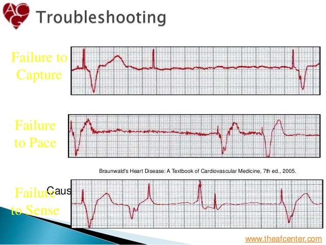 Perioperative cardiac device management