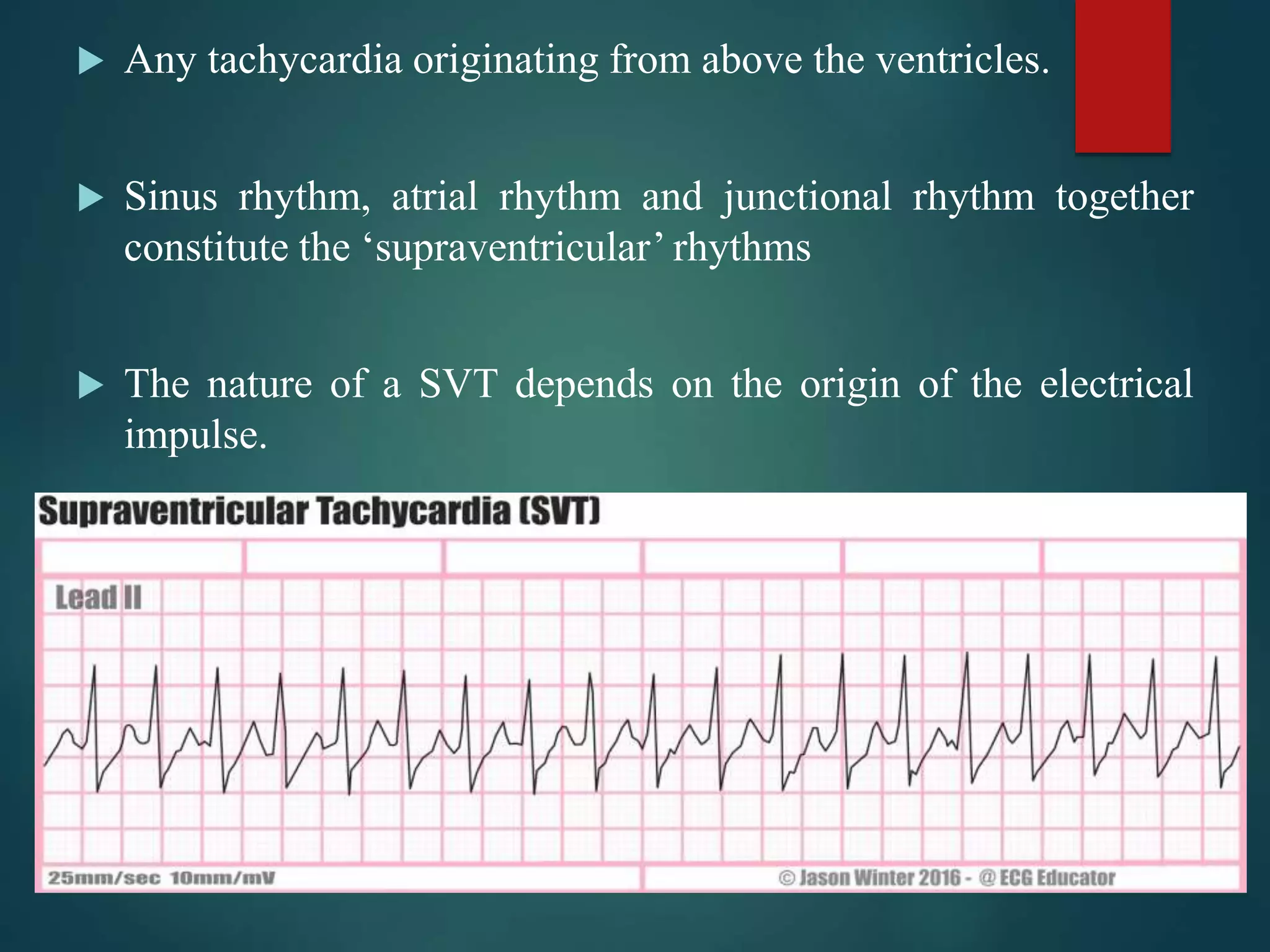 PERIOPERATIVE ARRYTHMIAS | PPTX