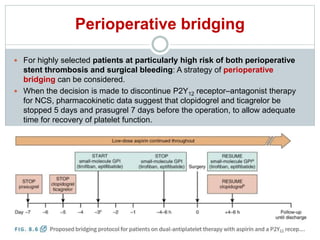 Perioperative cardiac assesment and interventions | PPTX