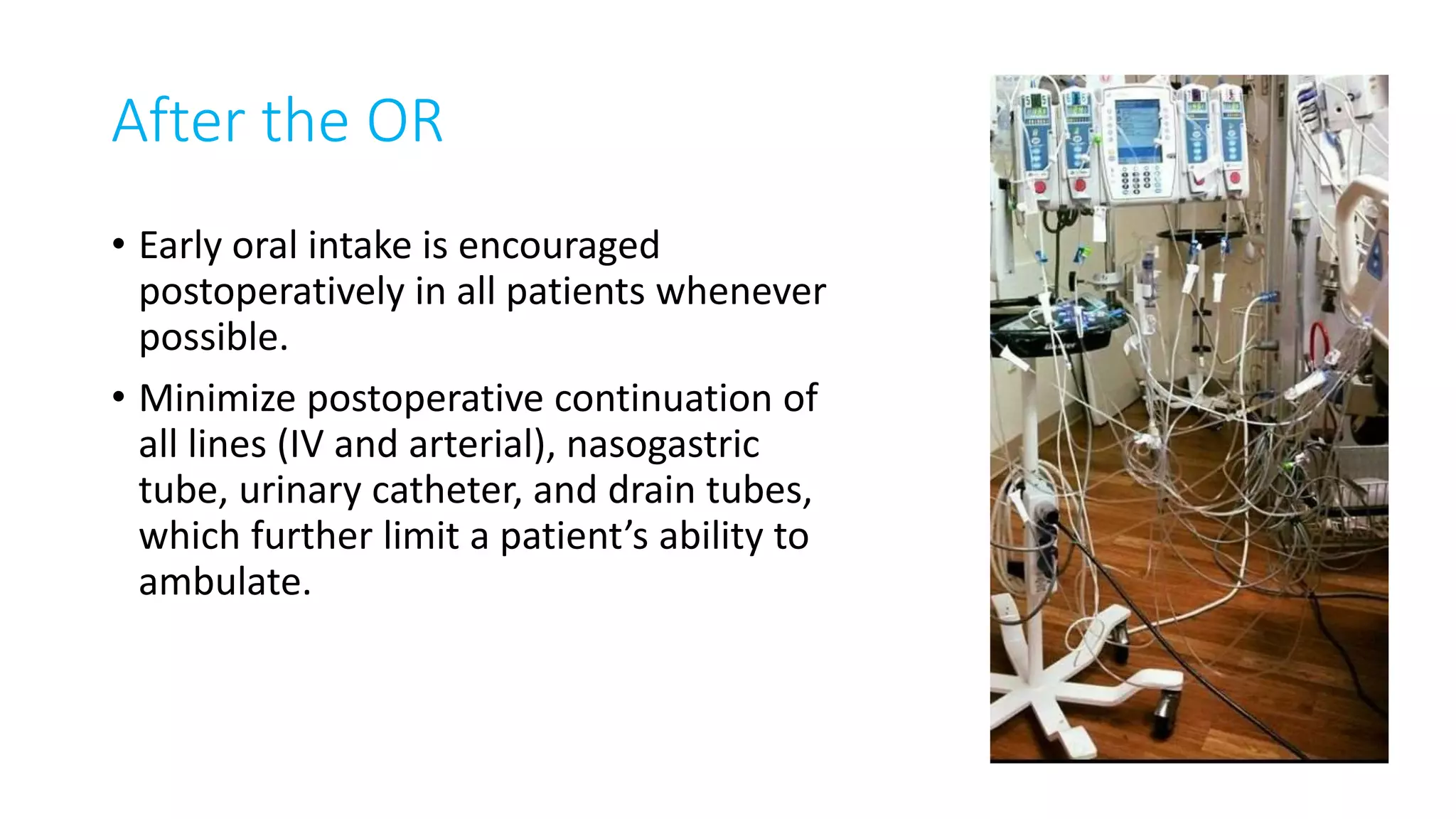 Perioperative fluid therapy for major surgery | PPSX
