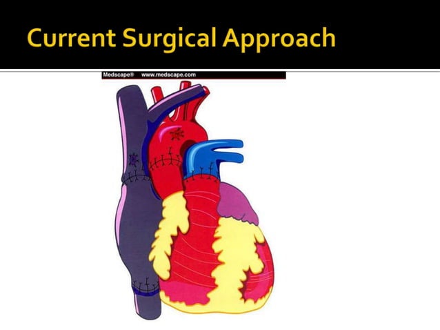 Perioperative Heart Transplant Management and Complications by Dr ...