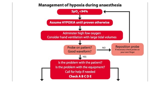 Perioperative hypoxia | PPTX
