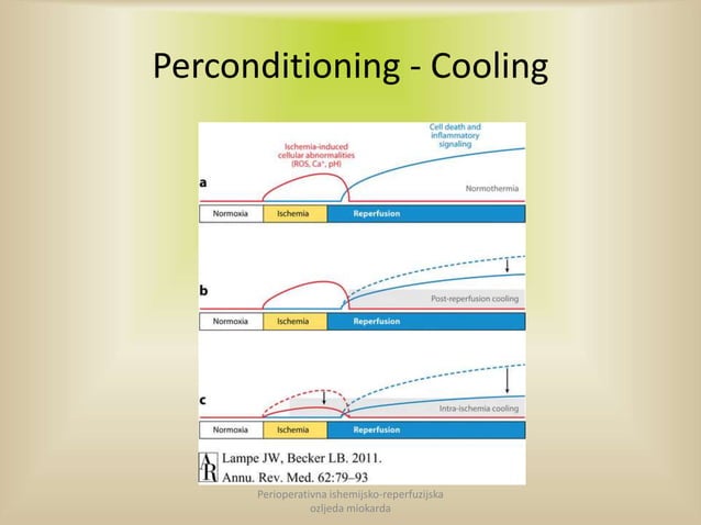 Perioperative ischemia–reperfusion injury of the heart | PPT