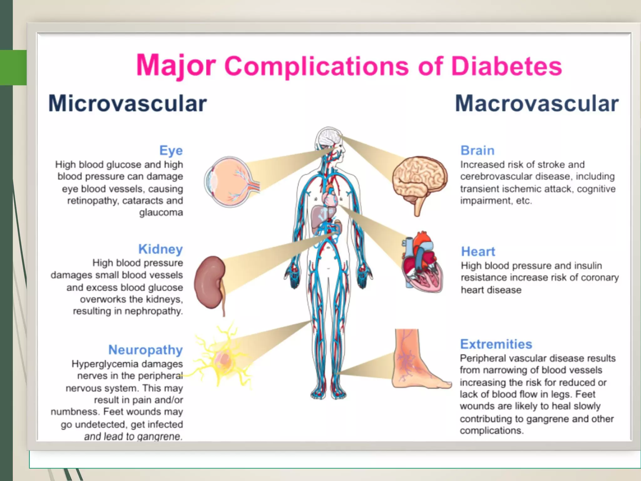 Perioperative management of the diabetic patient | PDF