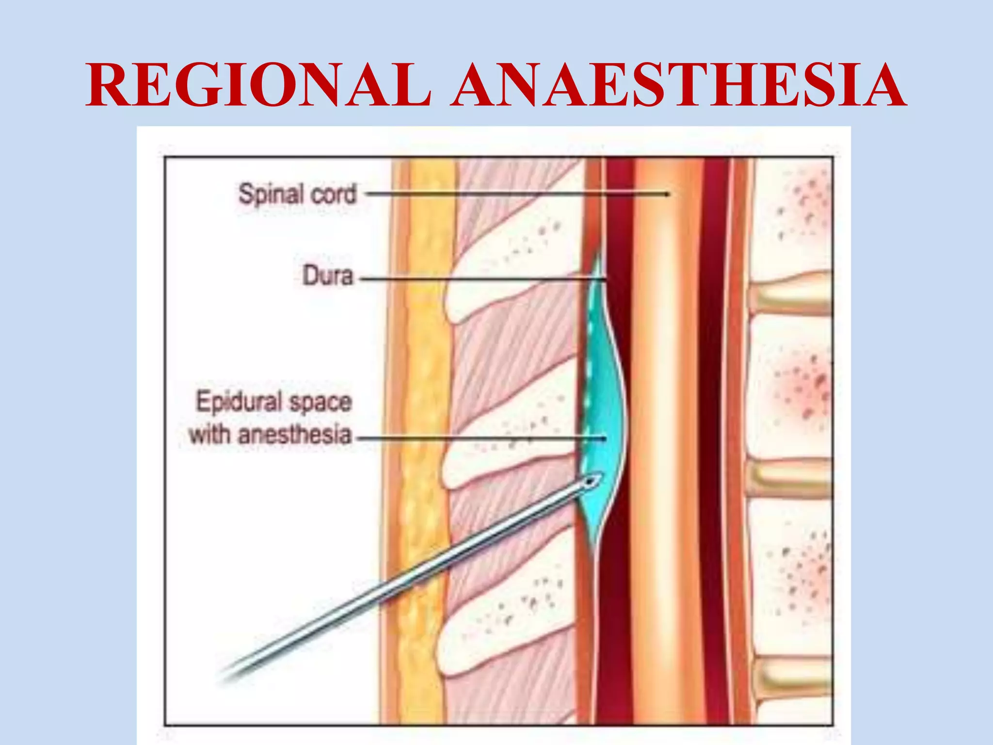 anesthesia- types of anaesthesia | PPTX