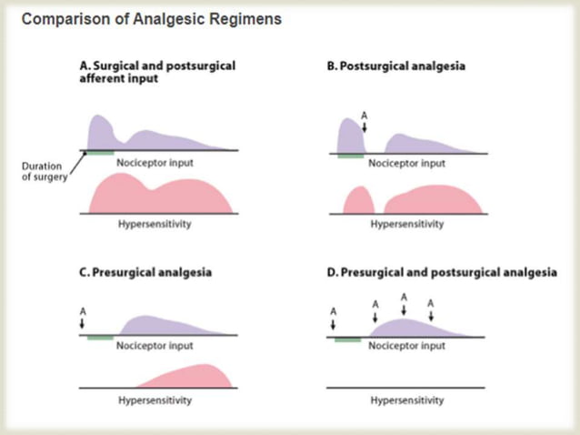 Perioperative pain management | PPTX