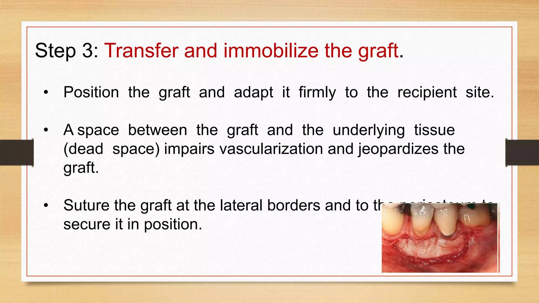 Periodontal plastic surgery | PPTX
