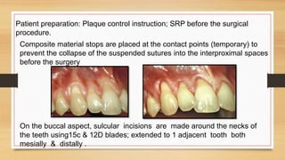 Periodontal plastic surgery | PPTX