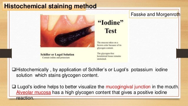 Perio plastic surgery