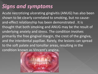 Smoking and periodontitis | PPTX