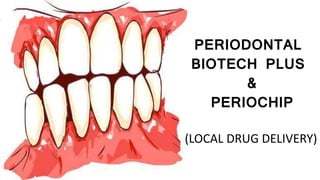 Local drug delivery in periodontics | PPTX