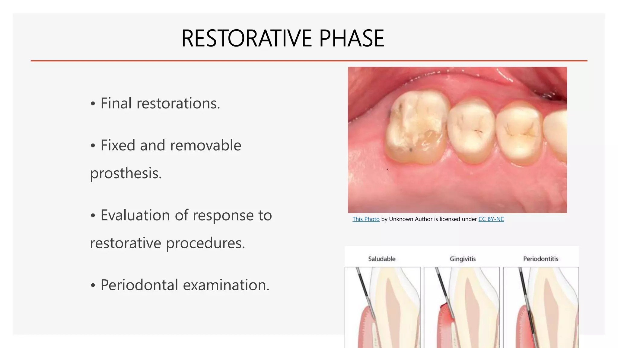 PERIO PPT TREATMENT PLAN.pptx