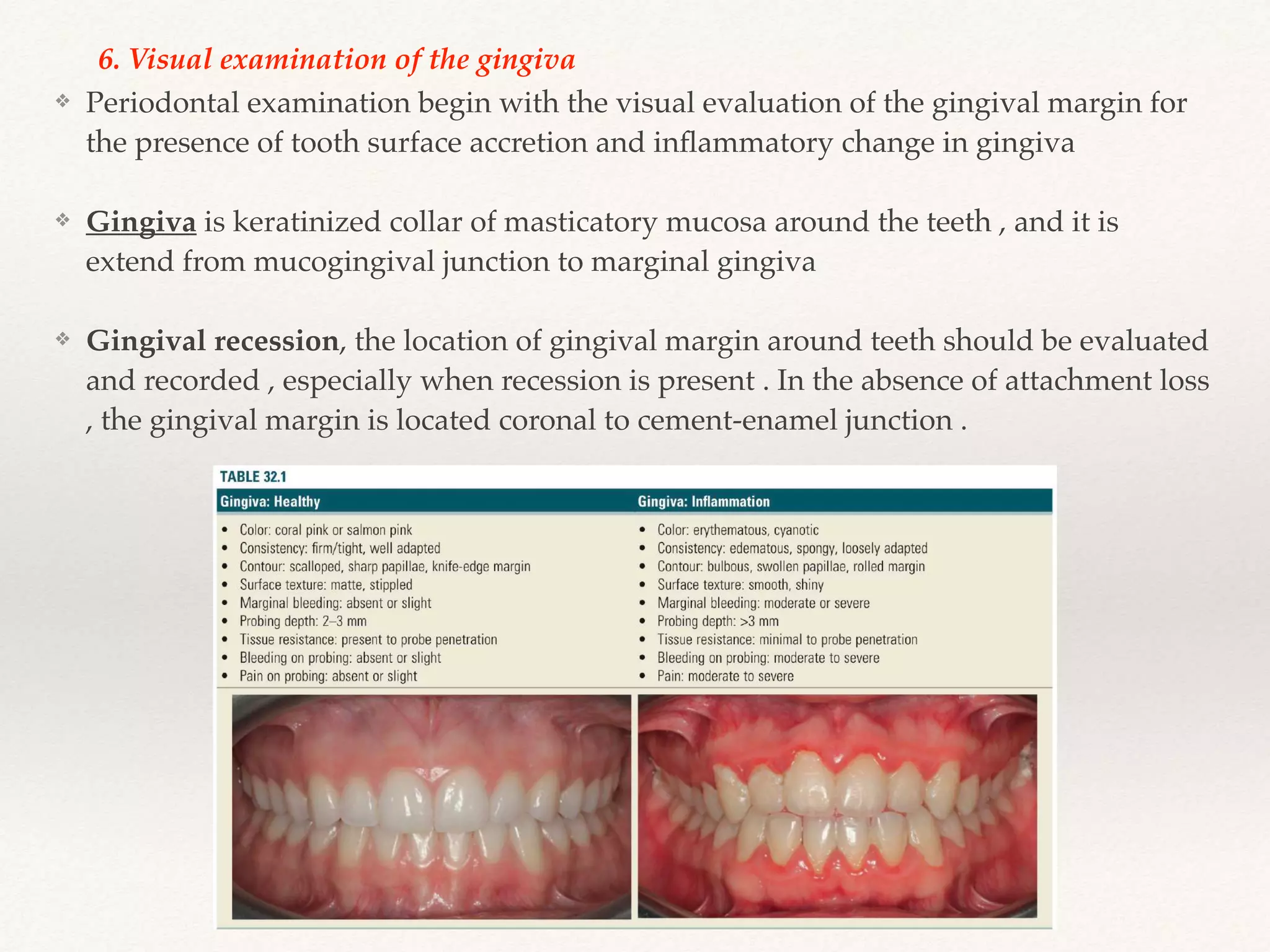 Perio presentation pdf | PPT