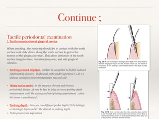 Perio presentation pdf | PPT