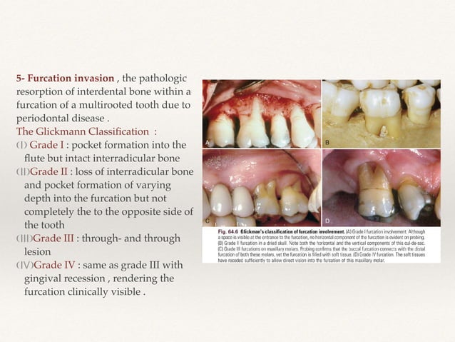 Perio presentation pdf | PPT