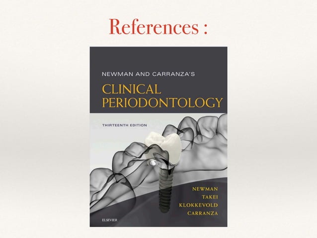 Perio presentation pdf | PPT