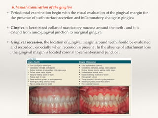 Perio presentation pdf | PPT