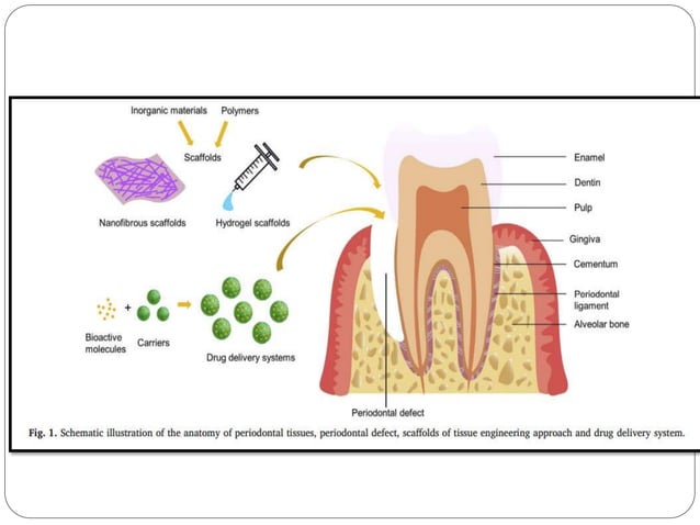 periodontal regeneration.pptx