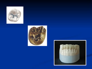 Perio restorative inter_relationship_ii__perio_ | PPT