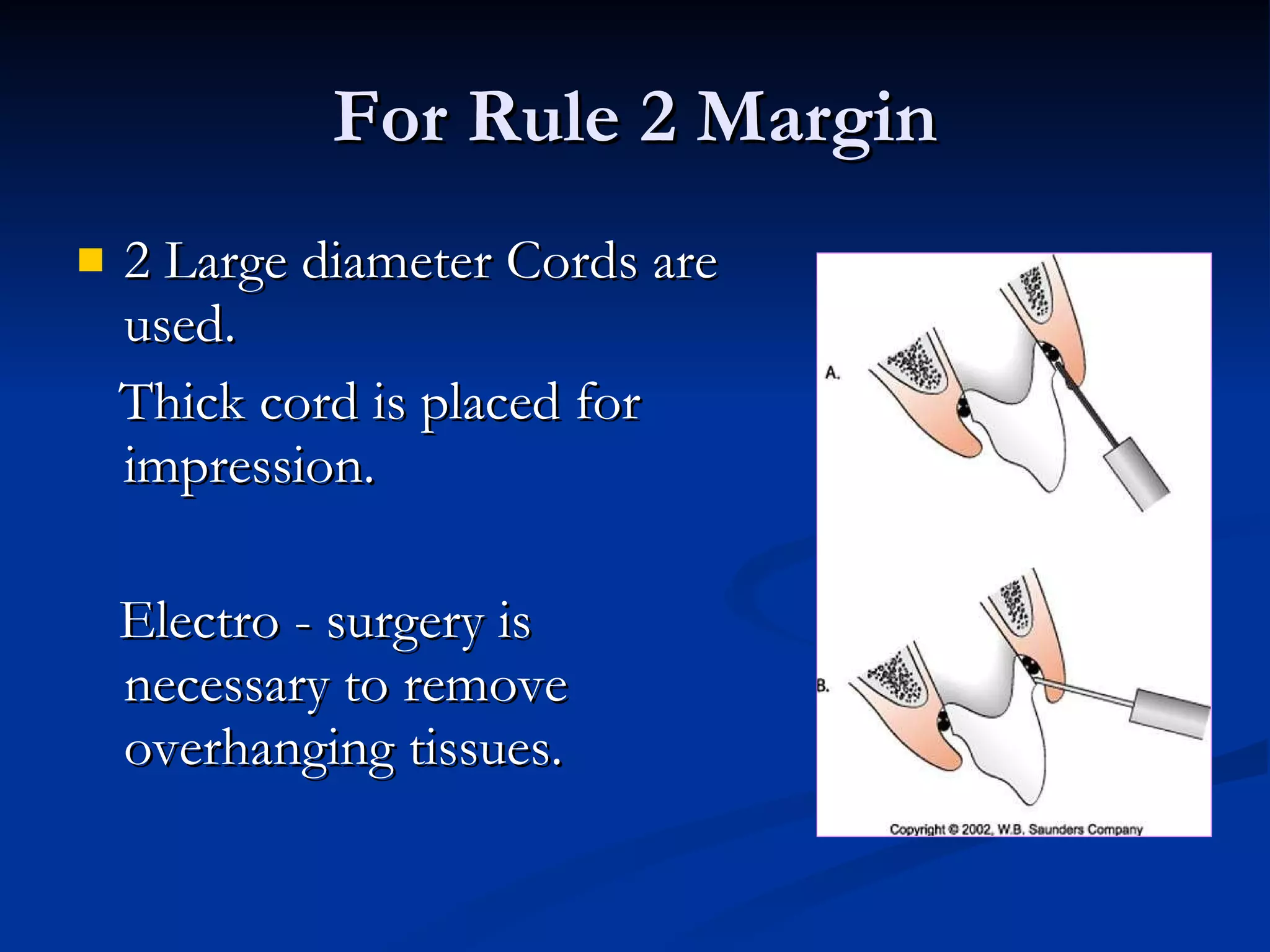 Perio restorative interelationship(periodontics) | PPT