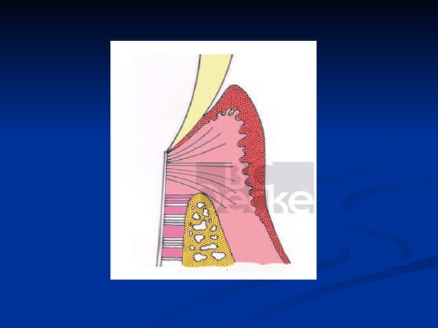 Perio restorative interelationship(periodontics) | PPT | Dental Health ...