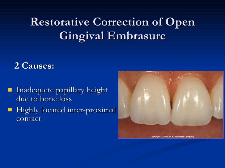 Perio restorative interelationship(periodontics)