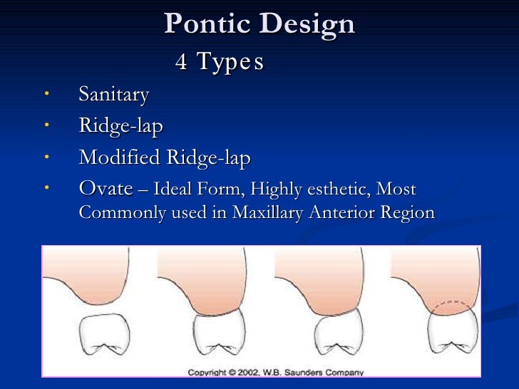 Perio restorative interelationship(periodontics)