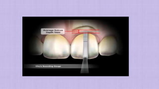 Perio restorative inter relationship lecture.pdf