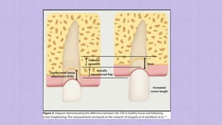Perio restorative inter relationship lecture.pdf