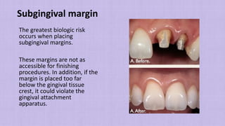 Perio restorative inter relationship lecture.pdf
