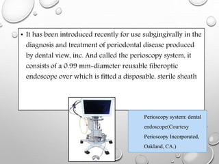 Perioscope | PPTX