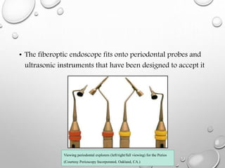 Perioscope | PPTX
