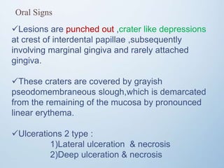 Acute gingival infections | PPT