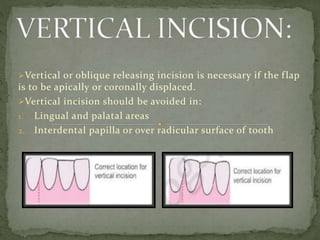 Periodontal Flap.pptx