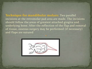 Periodontal Flap.pptx