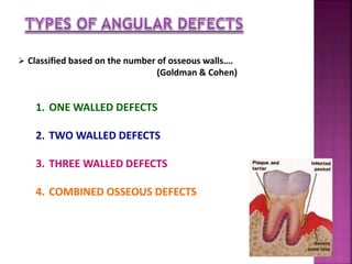 Patterns of bone destruction in periodontics | PPTX