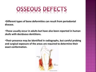 Patterns of bone destruction in periodontics | PPTX